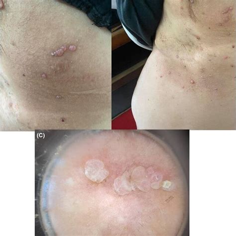 Whole Organ 3d Imaging Of Mouse Lymphatic Vessels A The 3d Whole Organ Download Scientific