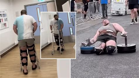 Strongman Gives Update From Hospital After Snapping Both Tendons