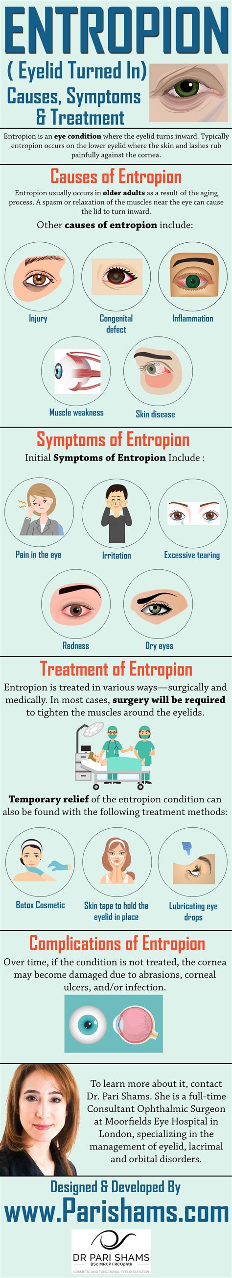 Entropion And Ectropion Causes Symptoms And Treatment Ectropion Boise