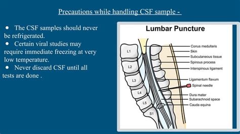 Cerebrospinal Fluid Csf Examinationpptx