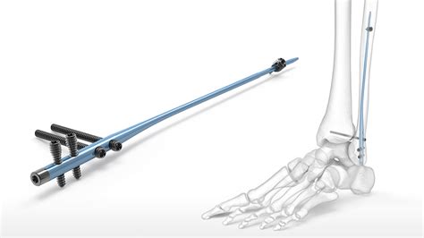 Fibula