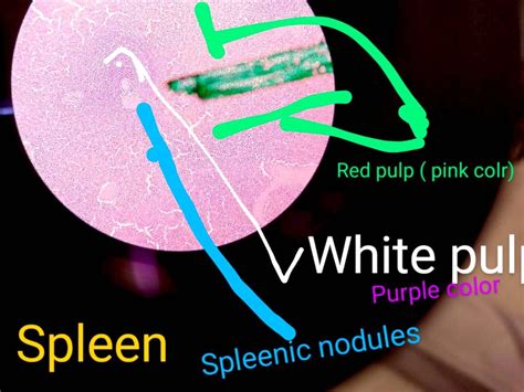 Spleen Histology The Spleen Is A Secondary Lymphoid Organ Located In