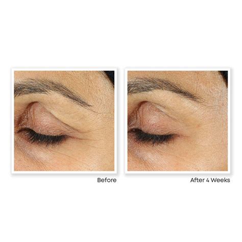 Retinol Correxion® Under Eye Cream Slow Aging Roc® Skincare