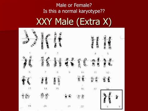 Ppt Karyotypes Powerpoint Presentation Free Download Id 9698794