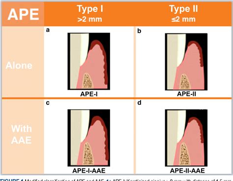 Figure 1 From Altered Active And Passive Eruption A Modified