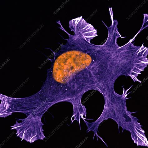 Ewing Sarcoma Cancer Cell Confocal Light Micrograph Stock Image C060 0057 Science Photo