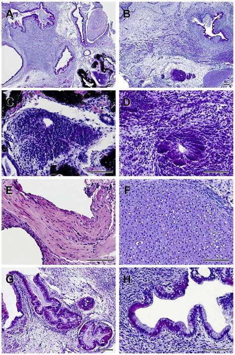 The In Vivo Differentiation Using Teratoma Formation Of Hipscs Adapted