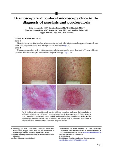 Pdf Dermoscopy And Confocal Microscopy Clues In The Diagnosis Of