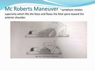 Recent Advances In Shoulder Dystocia Ppt Ppt