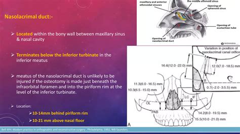 Maxillary Osteotomy Pptx