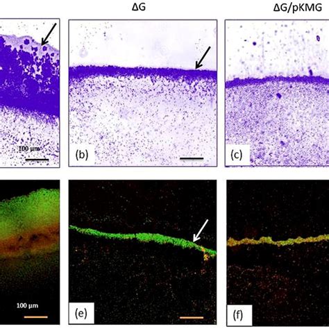 Nitrocefin Assay Denoting Comparative Expression Of Beta Lactamases A