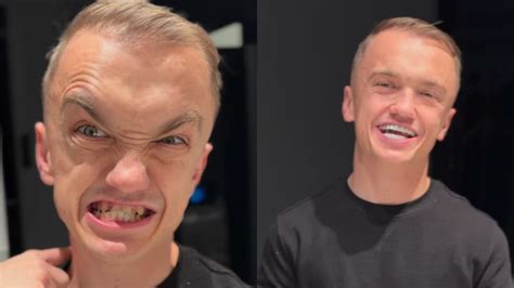 Mini Majk Będzie Miał Nowe ZĘby Rzadko Płaczę A Dziś Się Popłakałem