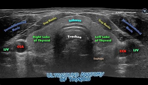 Labeled Thyroid Ultrasound