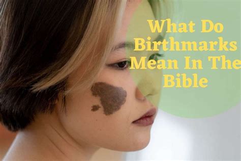 Birthmark On Left Arm Meaning Meanings Of Birthmarks Dwwitp
