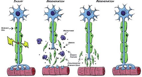 Wallerian Degeneration Wd Steps Download Scientific Diagram