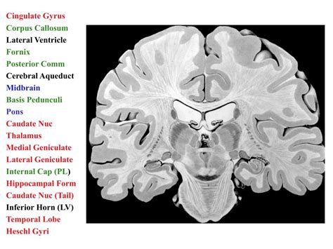 Ppt Cortex Cingulate Gyrus Precentral Gyrus Postcentral Gyrus