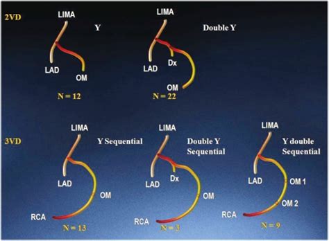 Construction Of A Composite Graft With Either The Radial Artery Or Download Scientific Diagram