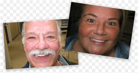 Smiling Patients Senior Citizen Face Person Head Art Png Flyclipart