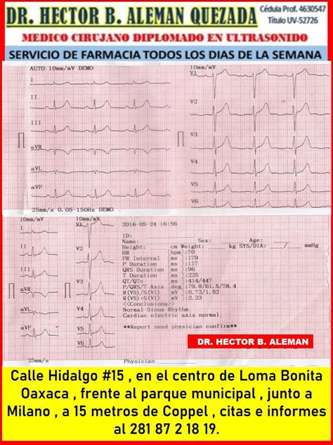 Servicio De Electrocardiograma Unidad Medica Santa Rita