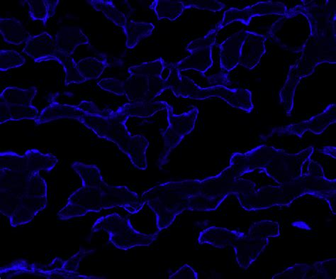 Detect Cells On Qupath Without Dapi Image Analysis Imagesc Forum