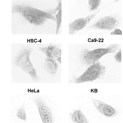 Vegf Expression And Secretion In Human Scc Cell Lines A Vegf Download Scientific Diagram