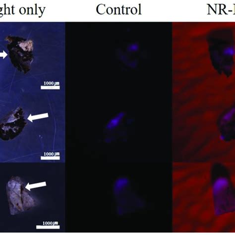 Identification Of Shape Of Microplastics On The Nile Red Plate Nr P