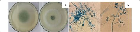 Characterization Of Trichoderma Strains By Macroscopic Morphology Of