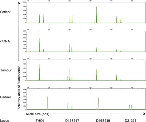 Circulating Cell Free Dna In The Diagnosis Of Trophoblastic Tumors Pmc