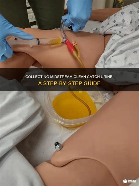 Collecting Midstream Clean Catch Urine A Step By Step Guide Medshun