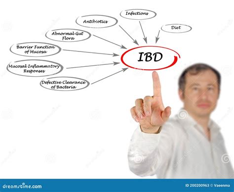 Causes Of Inflammatory Bowel Disease Stock Image Image Of Doctor