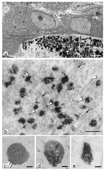 Matrix Vesicle Mediated Mineralization And Osteocytic Regulation Of