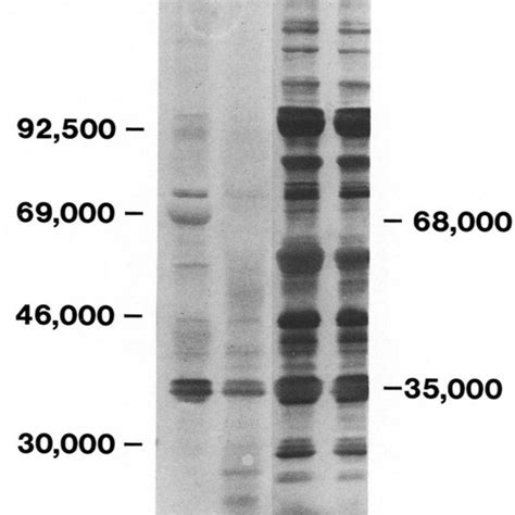 Immunoblot Analysis Of Antigens Present In Different Tick Instars