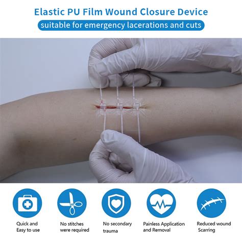 Elastic Pu Film Zip Tie Wound Closure Device For Emergency Wound