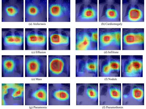 Sample Localization Heatmaps And Bounding Boxes Generated By Standard Download Scientific