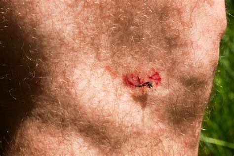 รูปภาพmosqito เลือกดูภาพถ่ายสต็อก เวกเตอร์ และวิดีโอ117 Adobe Stock