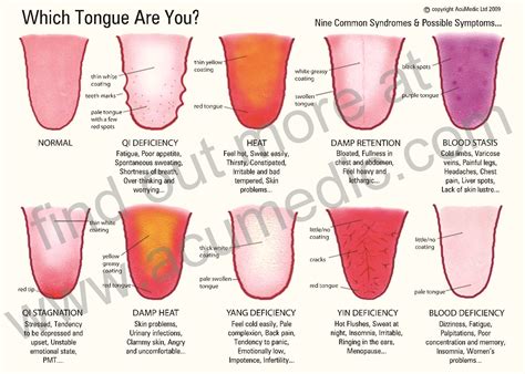 Basic Tongue Diagnosis Acumedic Clinic Tongue Health Chinese