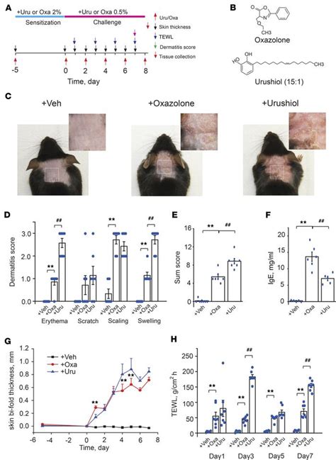 Jci Insight Transcriptome Profiling Reveals Th2 Bias And Identifies