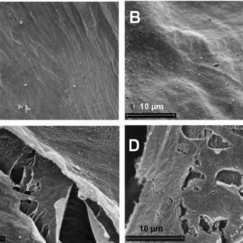 Scanning Electron Micrographs Showing Peritrophic Matrix Pm Of Fall