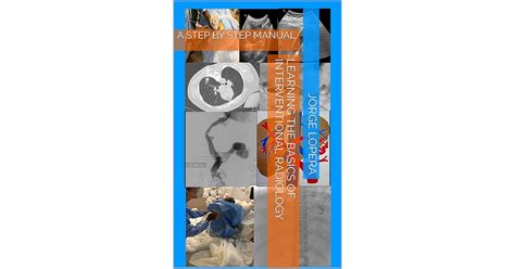 LEARNING THE BASICS OF INTERVENTIONAL RADIOLOGY A STEP BY STEP MANUAL By Jorge Lopera
