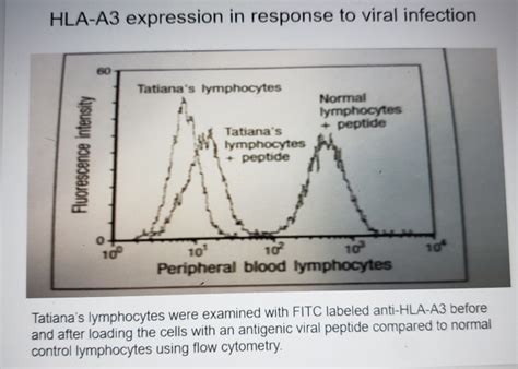 Solved If This Patient Has Igg2 Subclass Deficiency Based