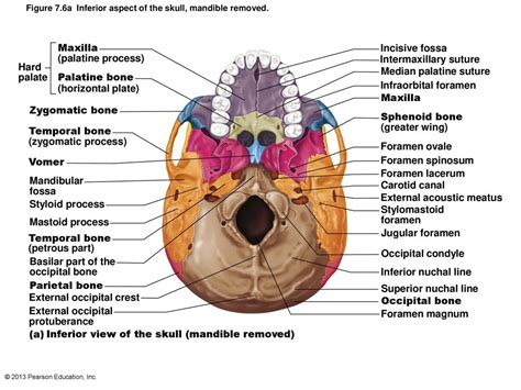 Maxillary Bone Inferior View