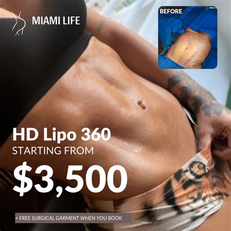 What Is Hd Lipo 360 With Ab Etching Miami Life Cosmetic Surgery