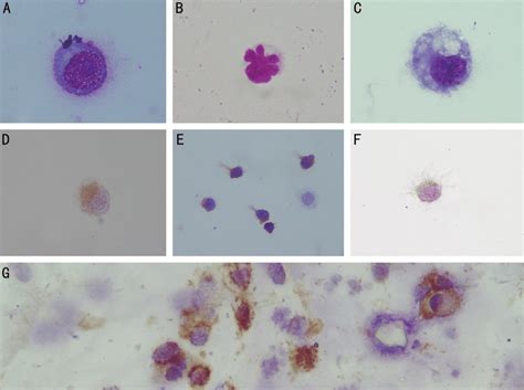 Wrights Staining 100× And Immunohistochemical Staining 40× Of Download Scientific Diagram