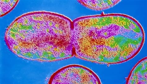 Streptococcus Bovis Identification