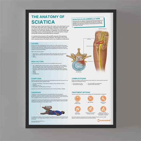 The Anatomy Of Sciatica Poster Nerve Pain And Spine Chart Anatomystuff