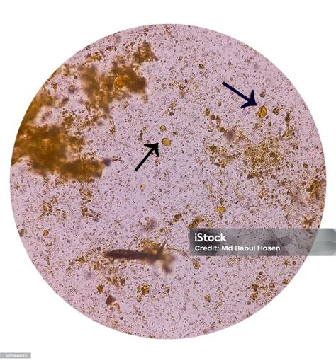 What Is Microscopic Examination Of Stool At Sharon Russell Blog