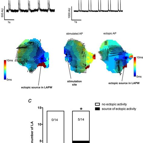 Activation Mapping Of Ectopic Action Potentials Aps Originating In