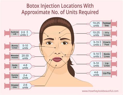 Printable Botox Charting Sheet Printable Free Templates