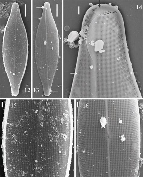 Gyrosigma Rostratum Sp Nov External Views Sem 12 13 Two Types Of
