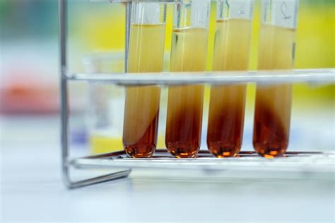 Eco Friendly Biodegradable Hydraulic Oil And Plant Based Grease Solutions